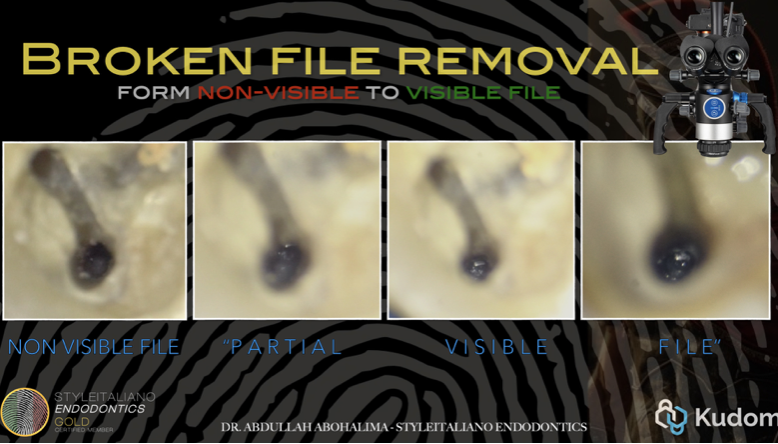 Transforming a Non-Visible Separated File into a Visible Fragment: A ...